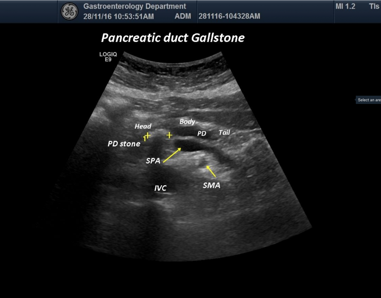 Acute and Chronic – EFSUMB