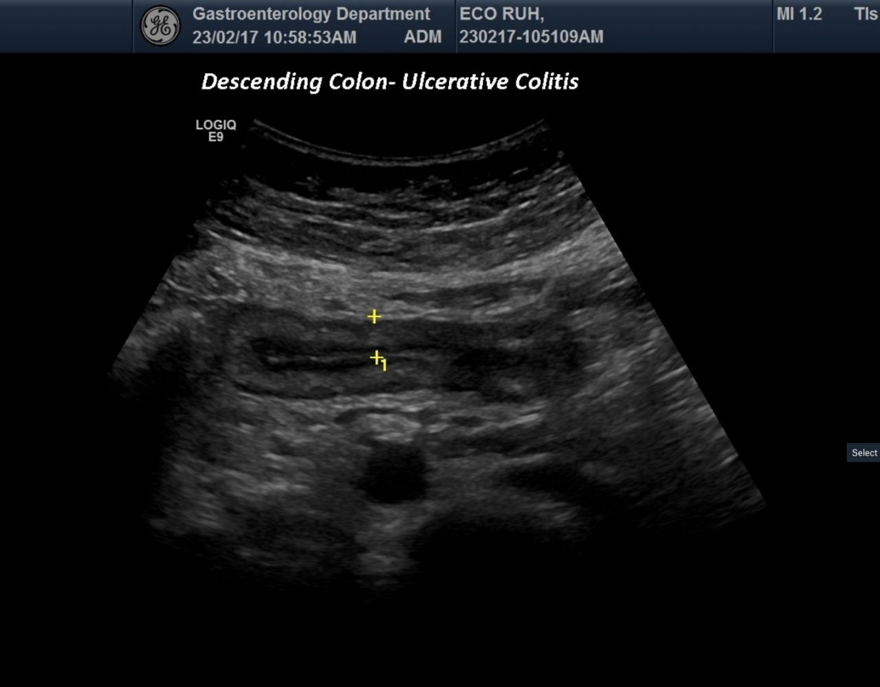 BASIC ULTRASOUND IMAGES – EFSUMB