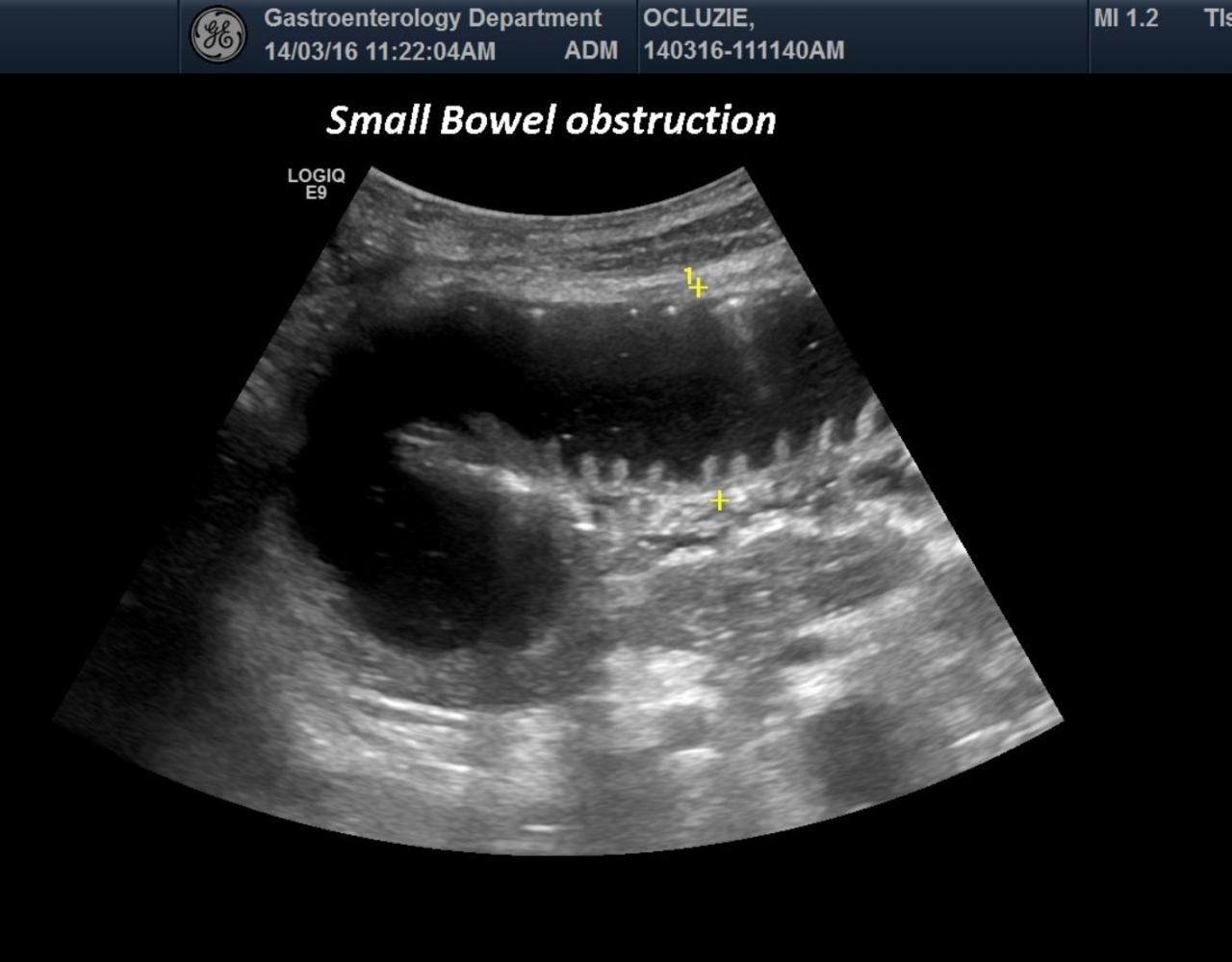 BASIC ULTRASOUND IMAGES – EFSUMB